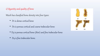 immediate implant and provisionalization.pptx