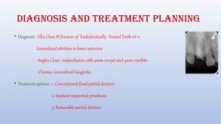 immediate implant and provisionalization.pptx