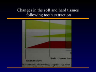 Immediate implant lecture | PPT