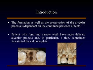 Immediate implant lecture | PPT