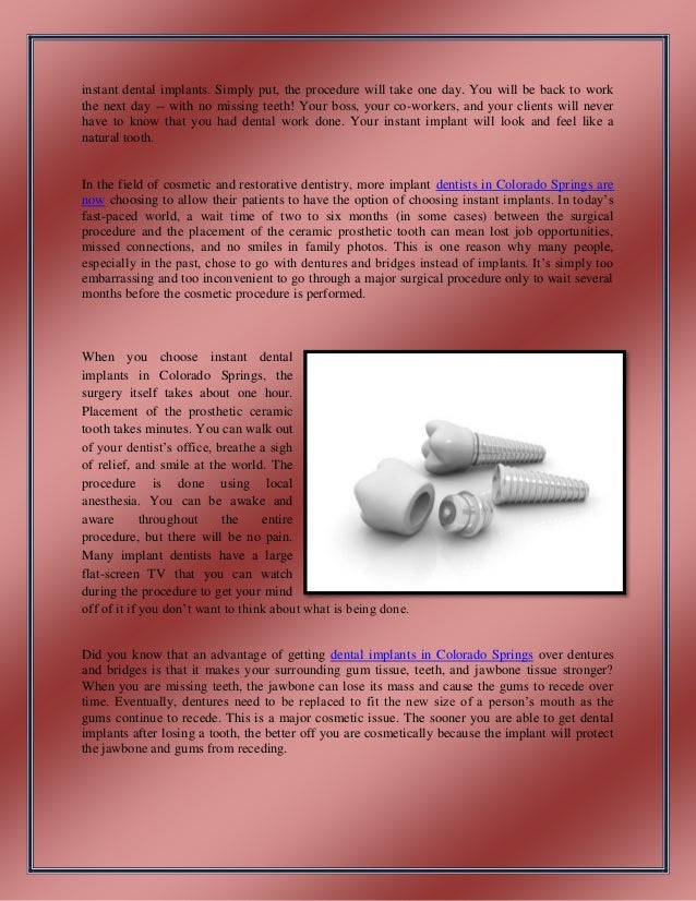 Immediate Load Dental Implants In Colorado Springs