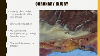 Immediate Intraoperative mitral valve repair complication ppt | PPT