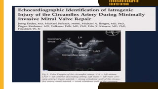 Immediate Intraoperative mitral valve repair complication ppt | PPT