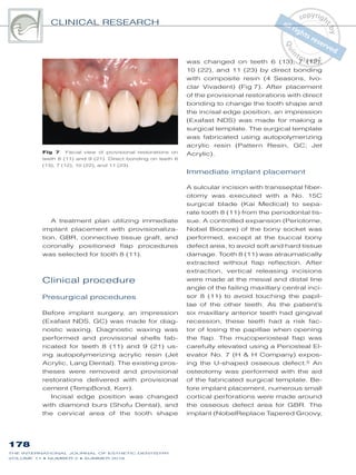Immediate placement and provisionalization of maxillary anterior single implant with guided bone ...