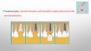 immediate placement with immediate loading.pptx