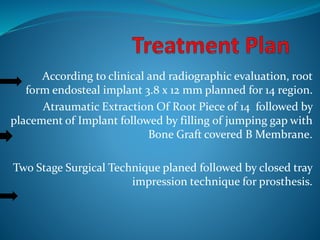 Immediate single implant case presentation | PPTX