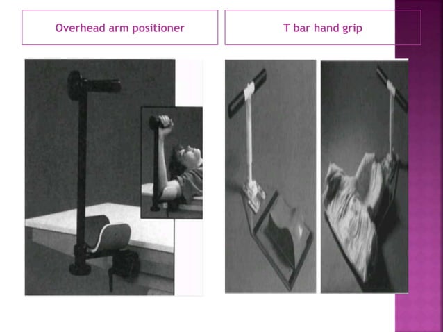 Immobilisation and stabilisation devices | PPTX