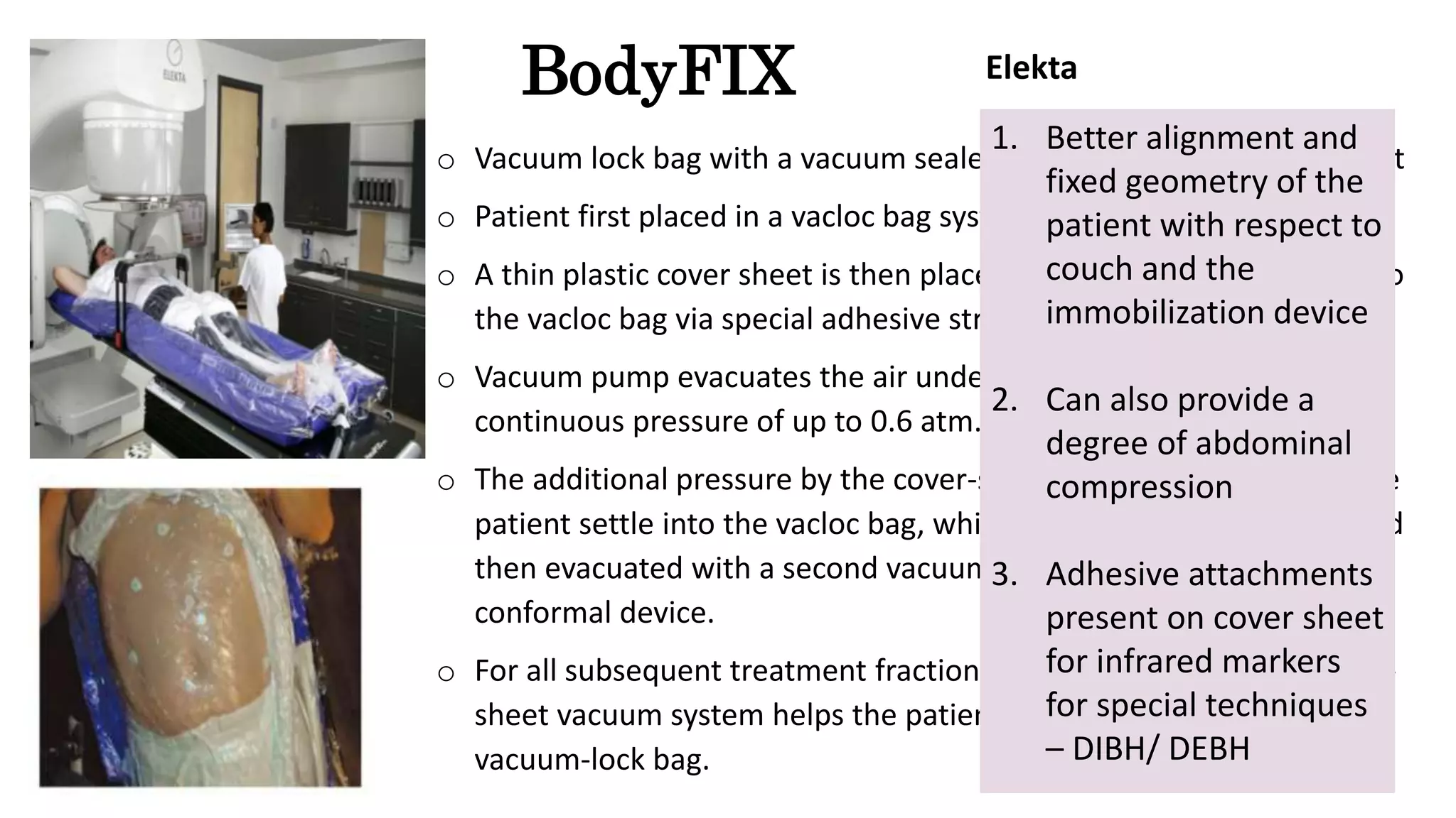 Immobilisation in Radiotherapy | PPTX