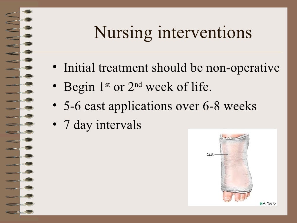 Immobility Definition