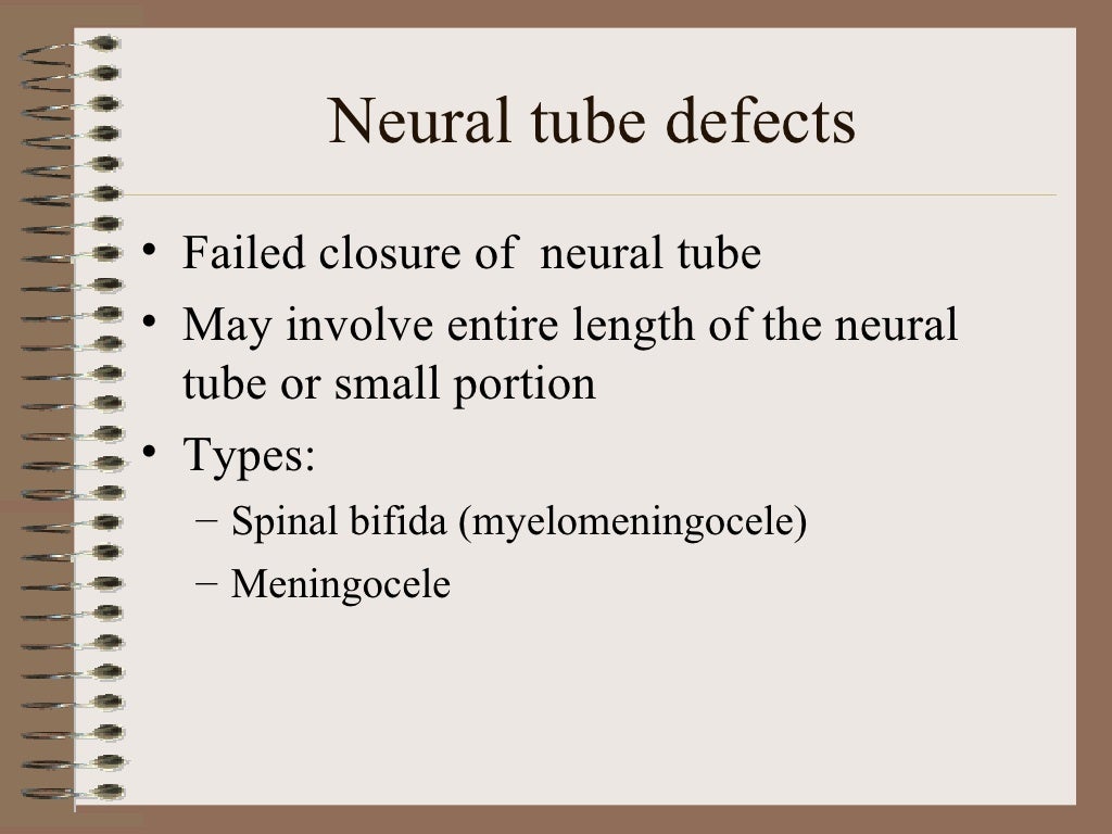 Immobility Definition