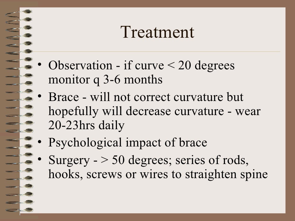 Immobility Definition