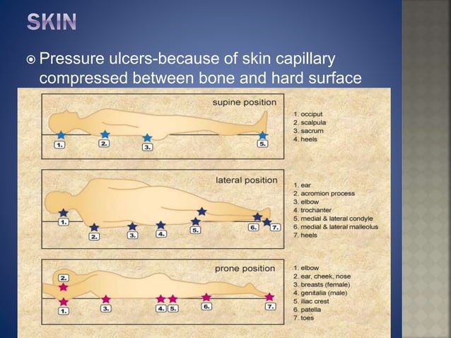 Immobility (Bed Rest Complications) | PPTX | Bone and Joint Conditions ...