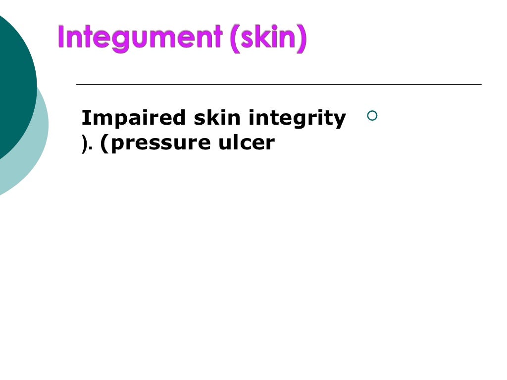 Immobility Definition