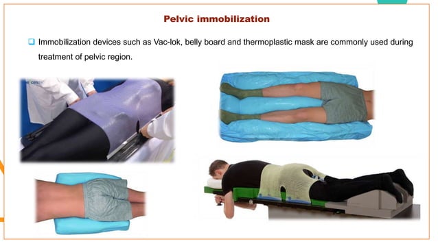 IMMOBILIZATION DEVICES IN RADIOTHERAPY.pptx | Cancer | Diseases and ...