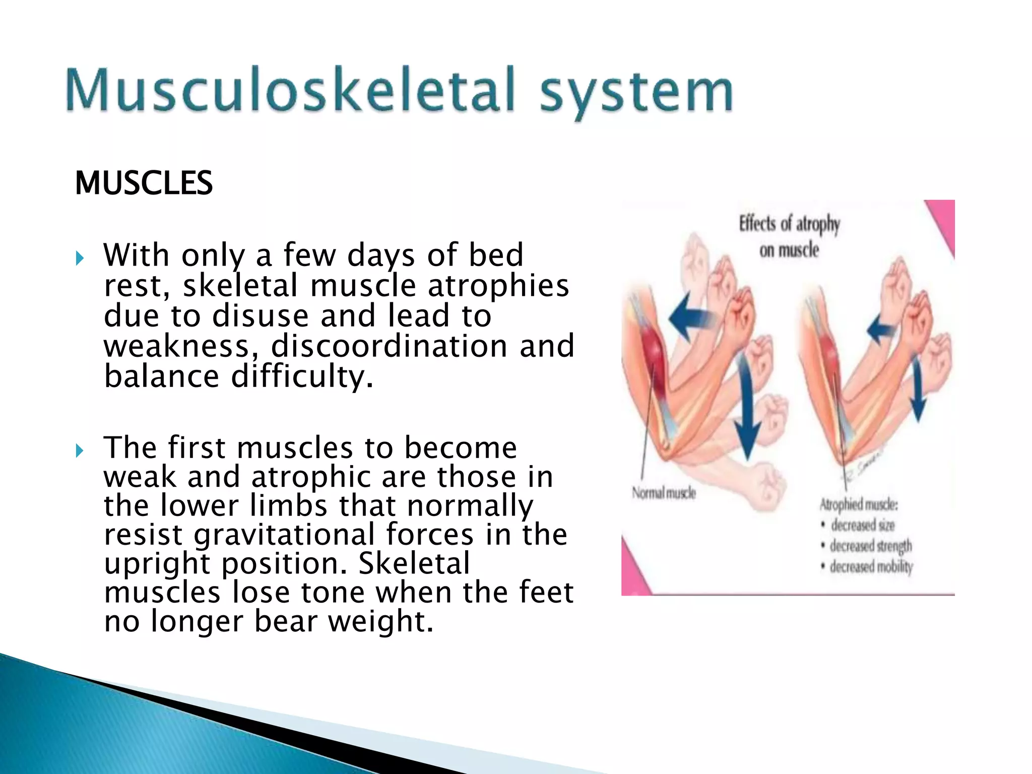 IMMOBILIZATION Effects.pptx