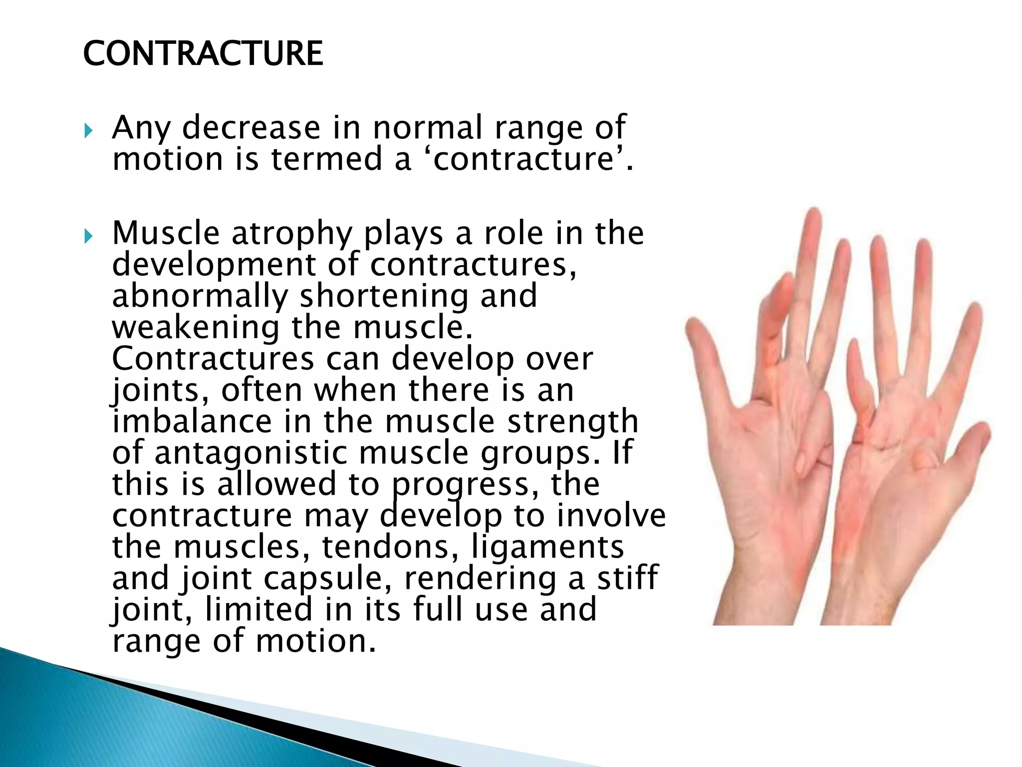 IMMOBILIZATION Effects.pptx