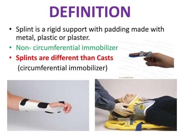 Immobilization splints | PPTX