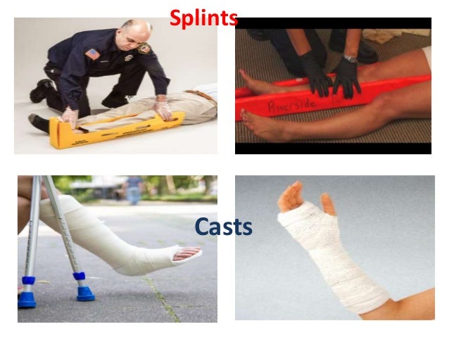 Immobilization splints