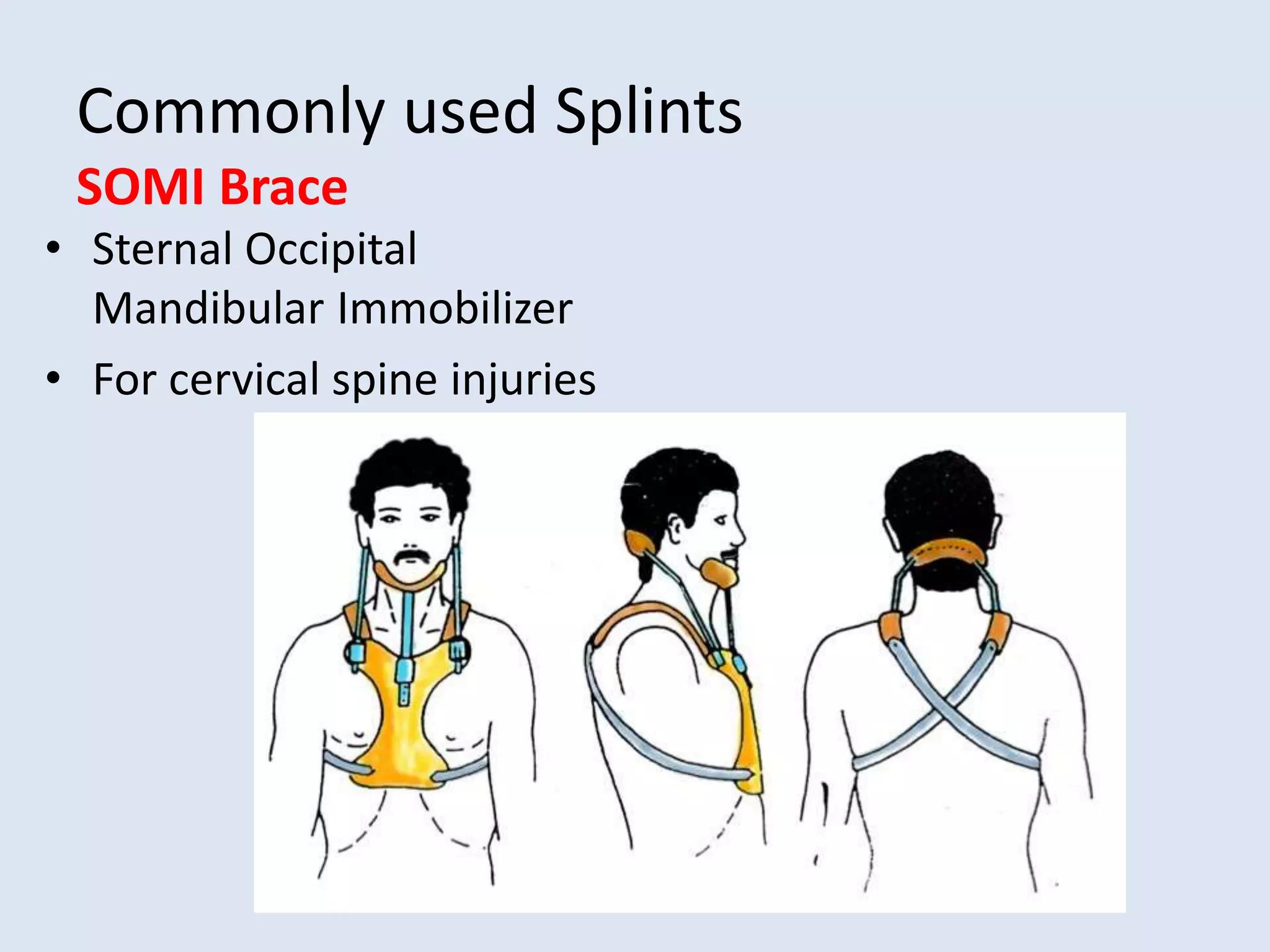 Immobilization used in Musculoskeletal injuries | PPTX