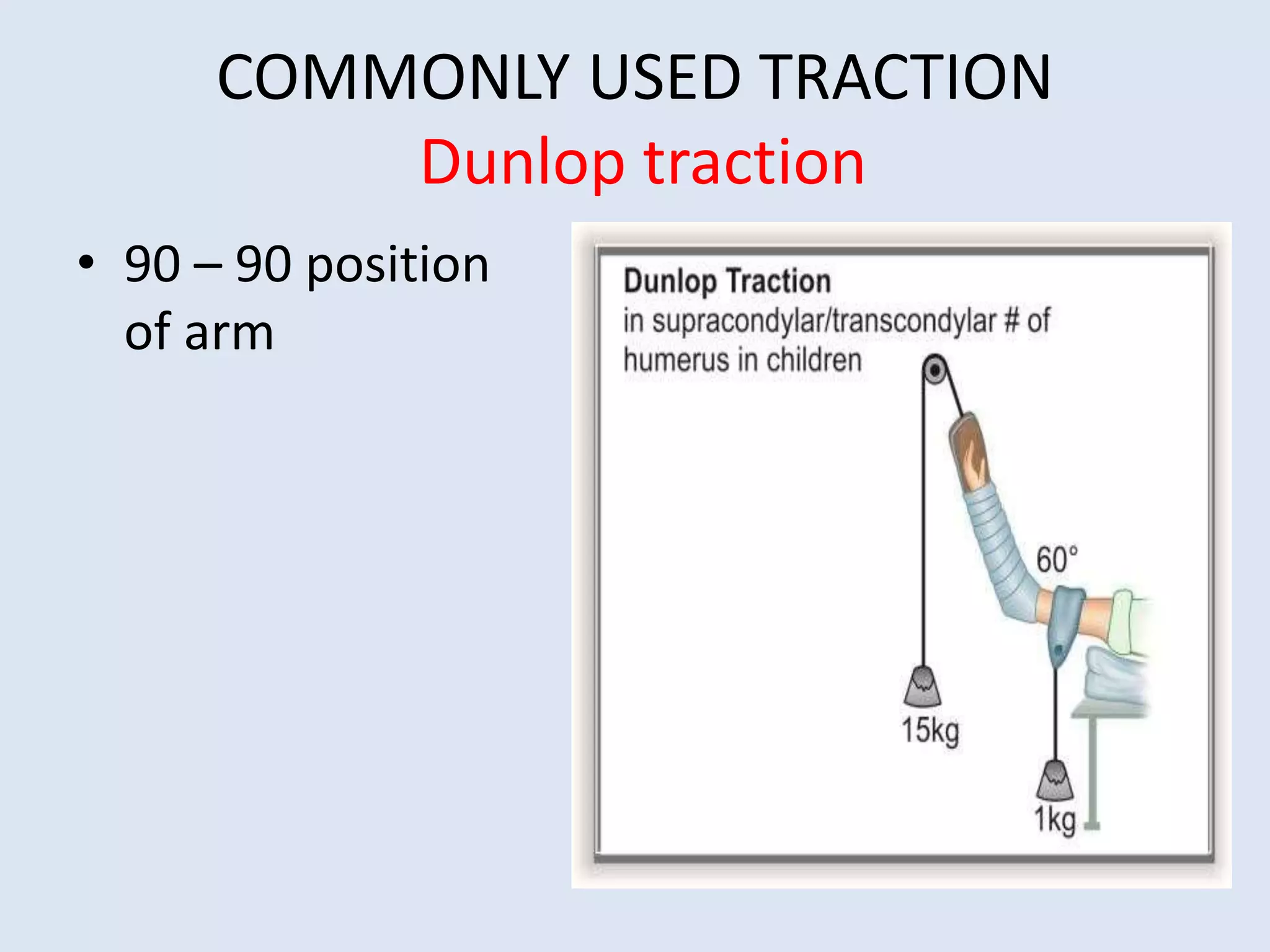 Immobilization used in Musculoskeletal injuries | PPTX