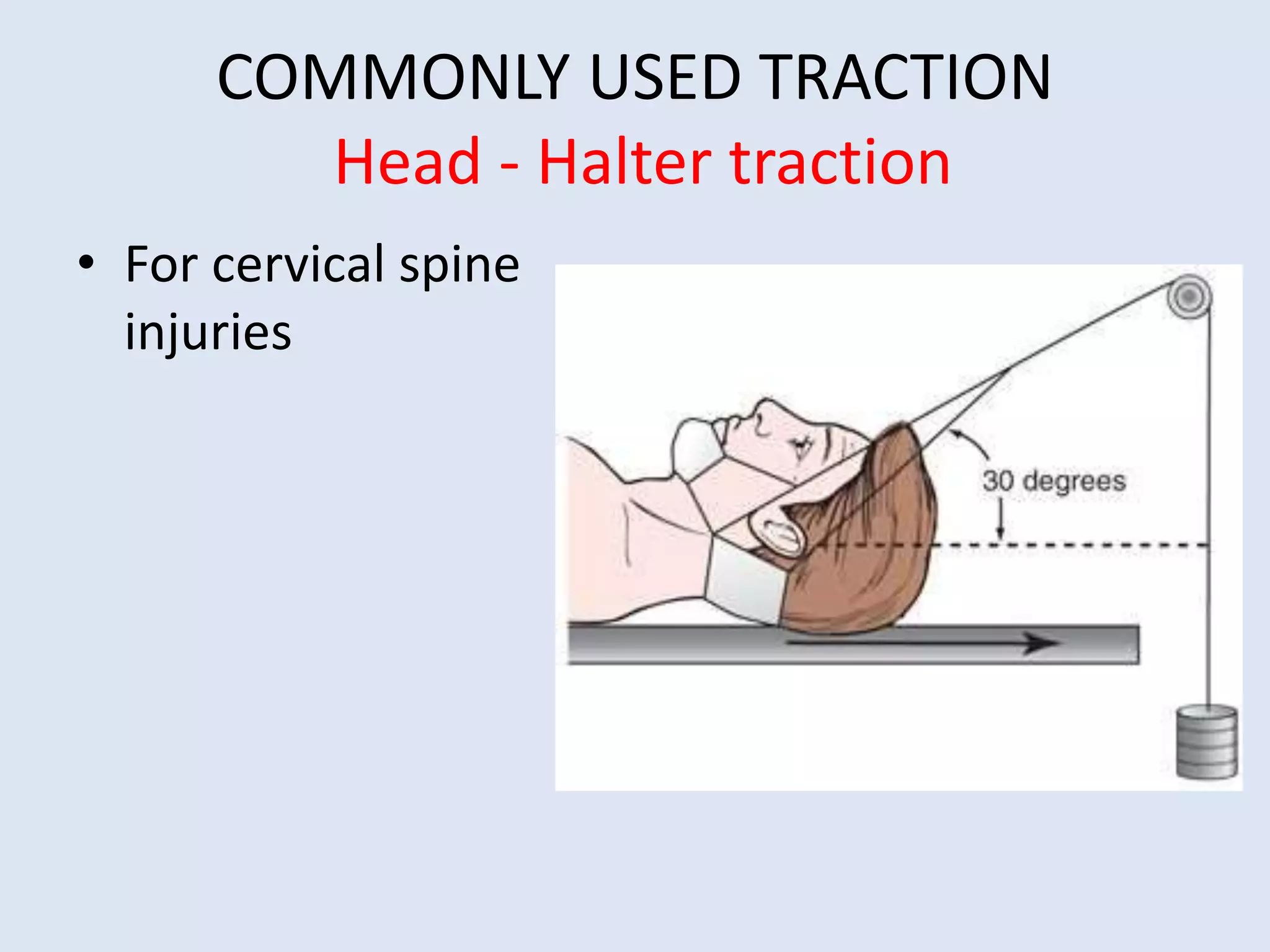 Immobilization used in Musculoskeletal injuries | PPTX