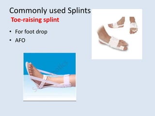 Immobilization used in Musculoskeletal injuries | PPTX