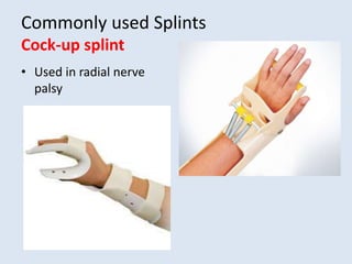 Immobilization used in Musculoskeletal injuries | PPTX