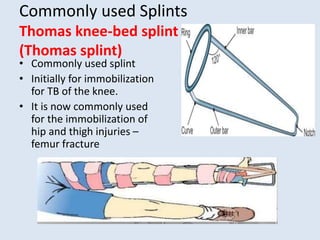 Immobilization used in Musculoskeletal injuries | PPT