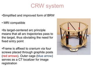 Immobilization techniques in SRS and SBRT | PPTX