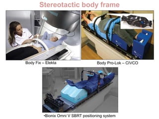 Immobilization techniques in SRS and SBRT | PPTX