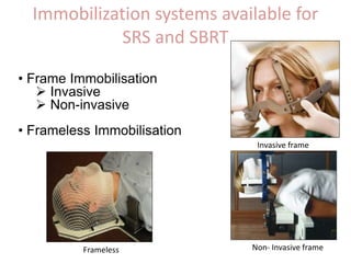 Immobilization techniques in SRS and SBRT | PPTX