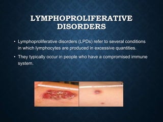 Immunoproliferative disorders[1] | PPTX