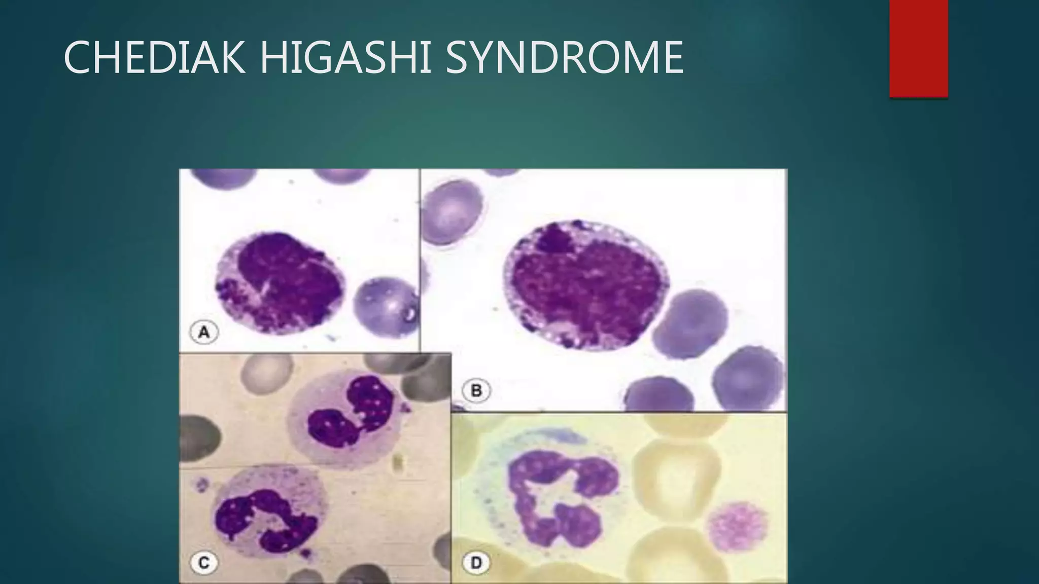 immundeficiencydiseases-160925065412.pdf
