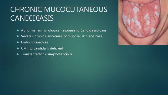 Immunodeficiency diseases