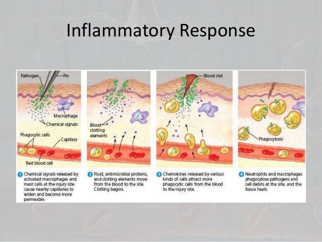 Immune System for Essentials of Healthcare