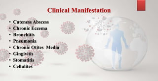 Immune Deficiency | PPTX