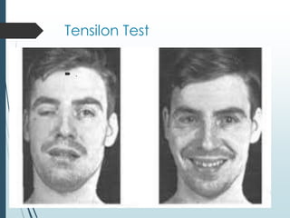 Immune disorders | PPT