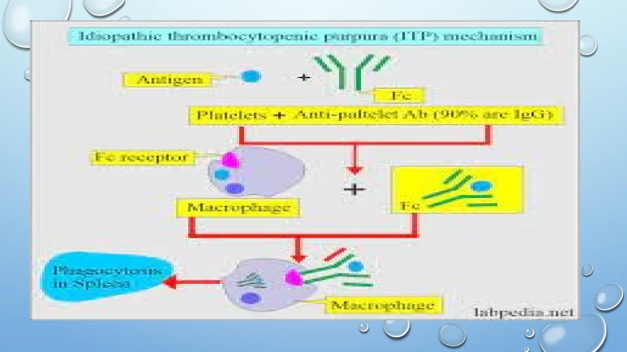 immune (idiopathic) thrombocytopenic purpura (.pptx
