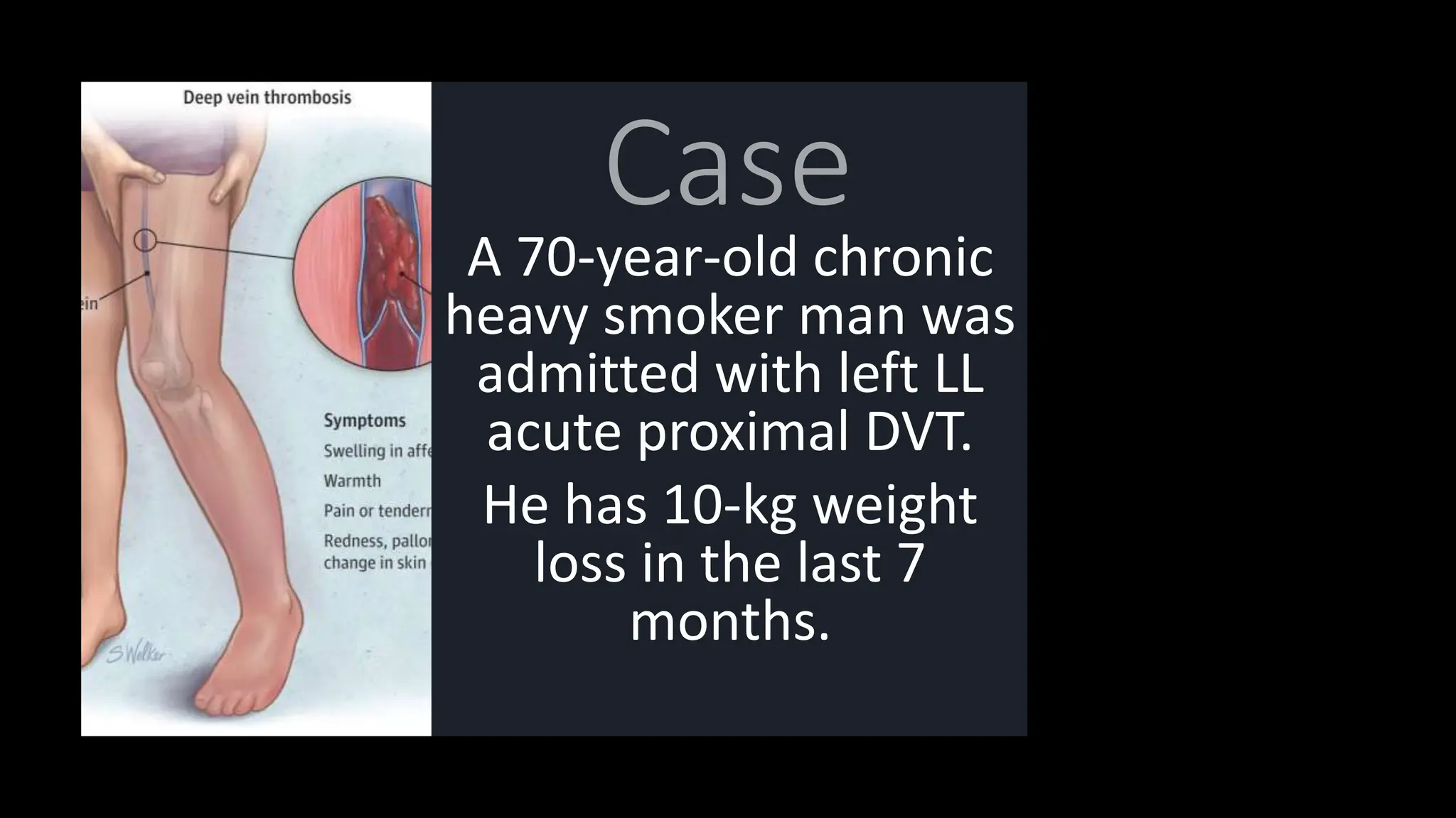 Immune labs basics part 1 acute phase reactants ESR, CRP Ahmed Yehia ...