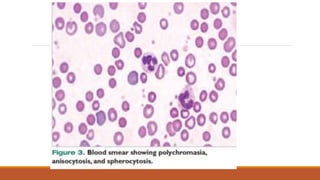 Polychromasia In Dogs