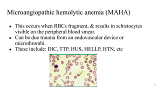 Immune & non immune hemolytic states- kananura keneth | PPT