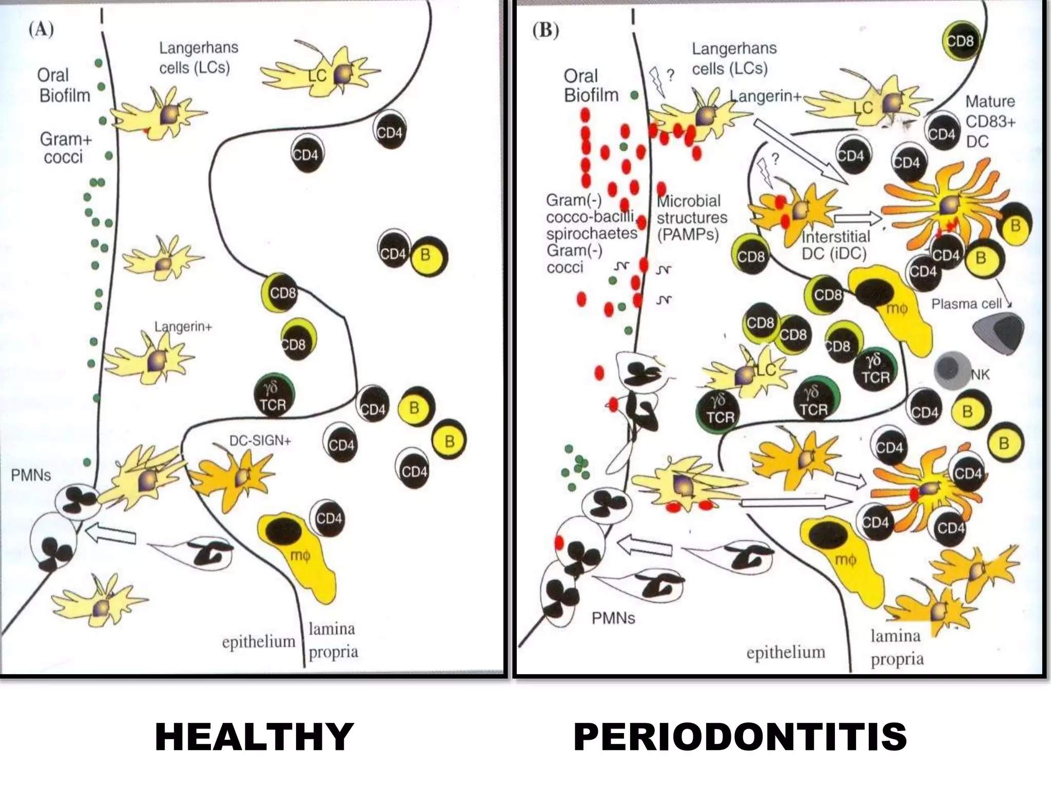 Immune responses in periodontal disease final.pptx