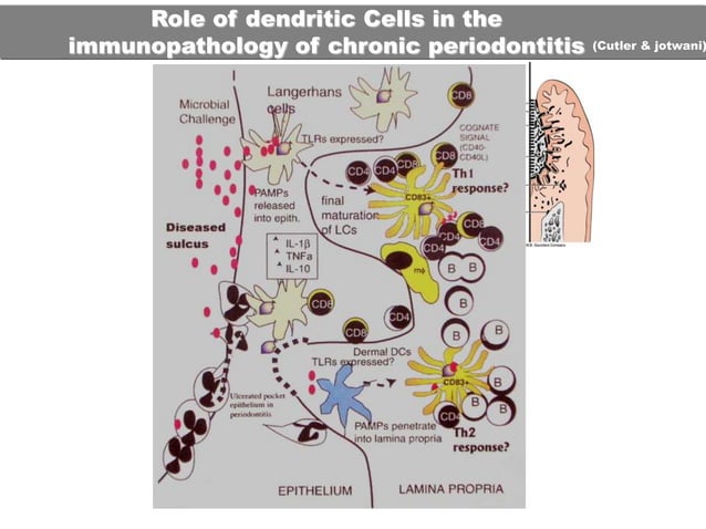 Immune responses in periodontal disease final.pptx | Dental Health ...