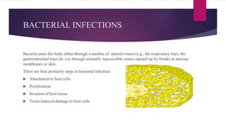 Immune responses to infectious diseases | PPTX
