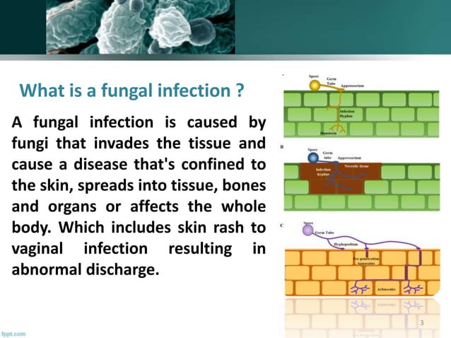 Immune response to fungal infection | PPTX