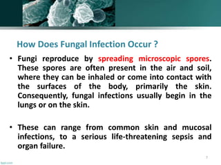 Immune response to fungal infection | PPTX