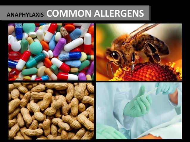 Immune System Disorders - Anaphylaxis, Angioedema, Drug Allergies | PPT ...