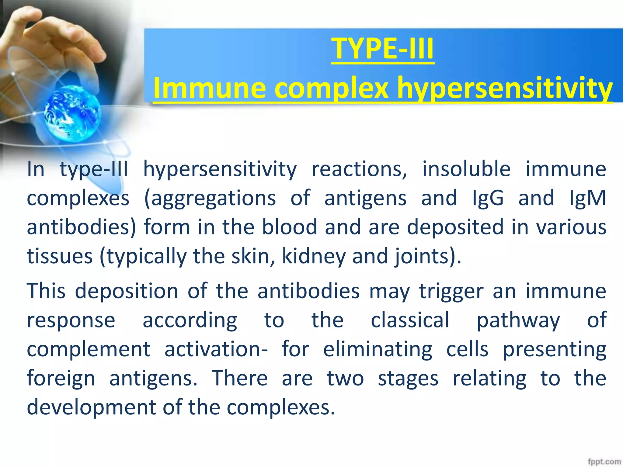 Immune system disorders | PPTX