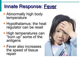 Immune System notes | PPT