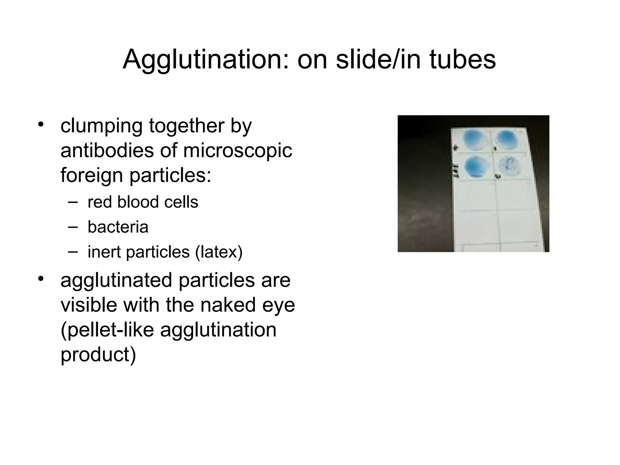 Immune tests in the laboratory diagnosis of infections | PPT